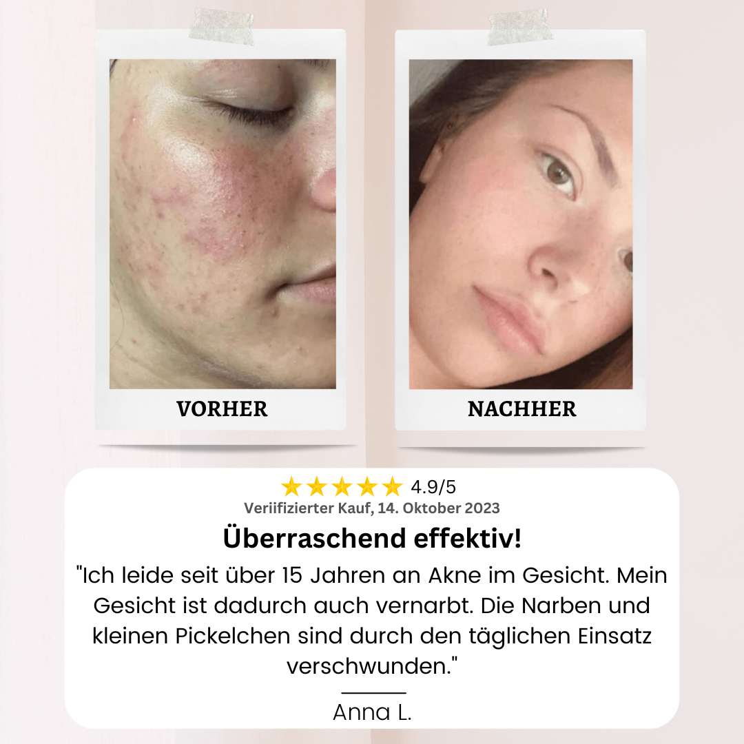 Finest Glass Skin – FinestFemme